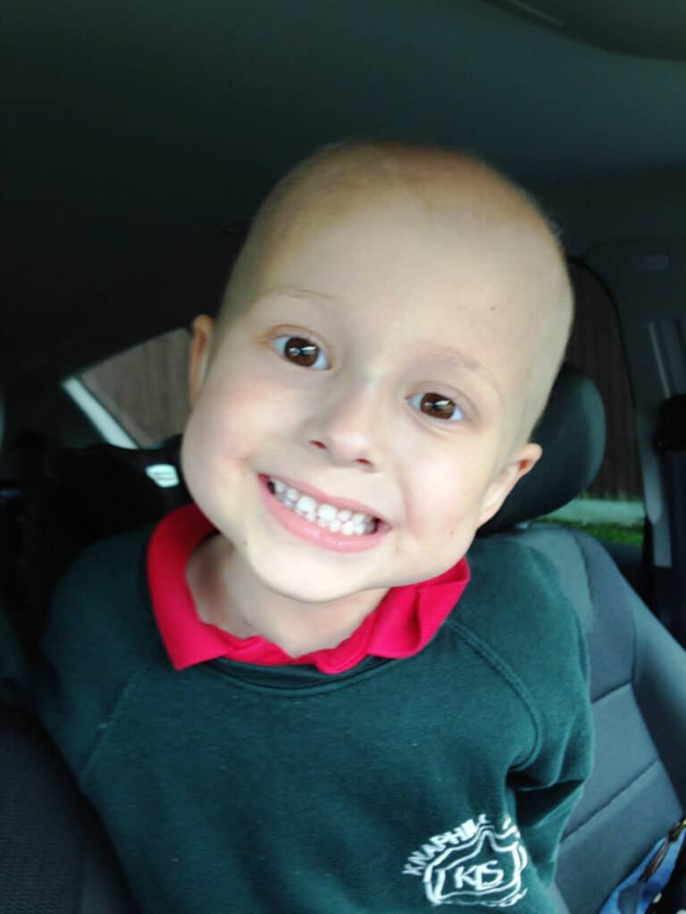 Jacob's limp reveals leukaemia diagnosis | Children with Cancer UK